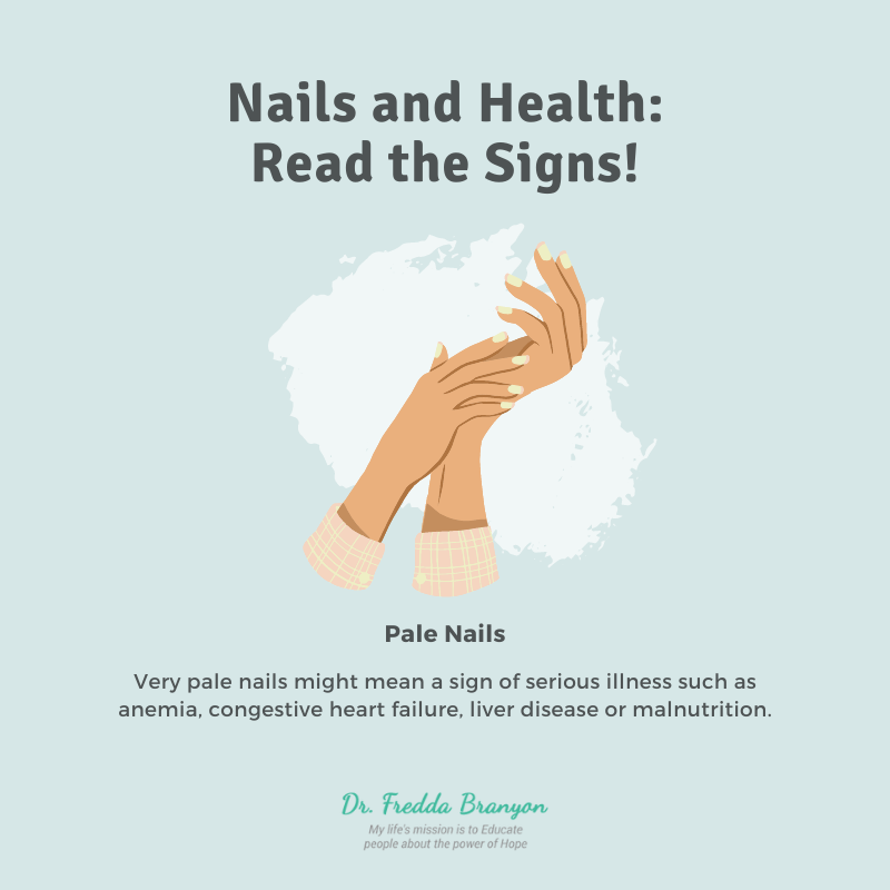 Read Those Nail Signals! | Dr. Fredda Branyon