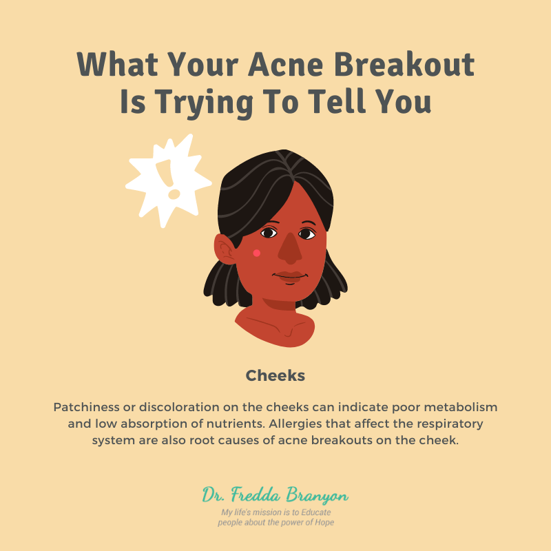 Connecting the Dots: What Your Acne Breakout Is Trying To Tell You | Dr ...